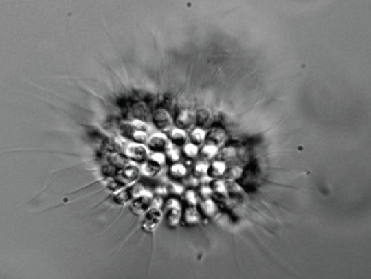 Choanoflagellates Under Microscope