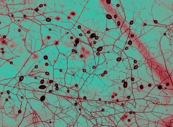 See the hidden fungal network so big it could stretch to Proxima ...