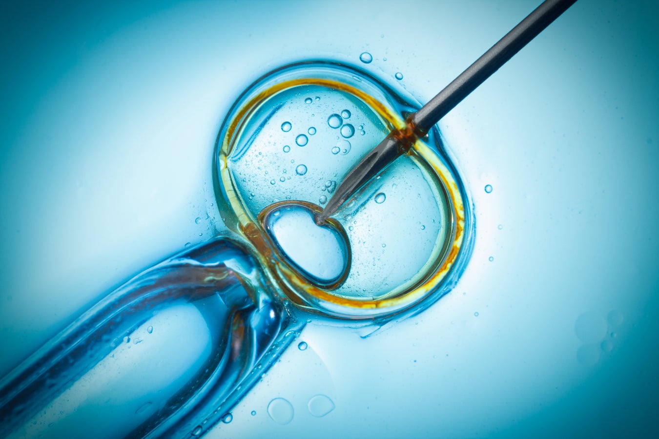 How Arguments that Embryos Are People Pose a Threat to IVF | Scientific ...