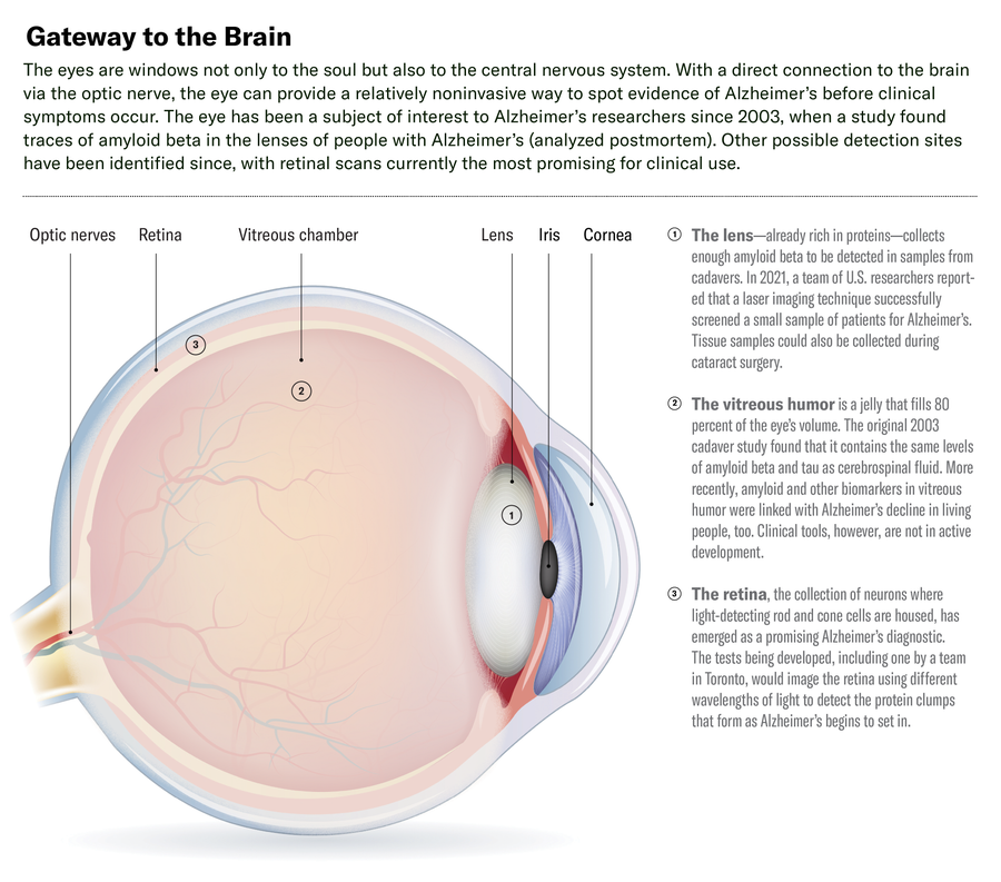 Eye Tests Could Help Preserve Brain Health | Scientific American