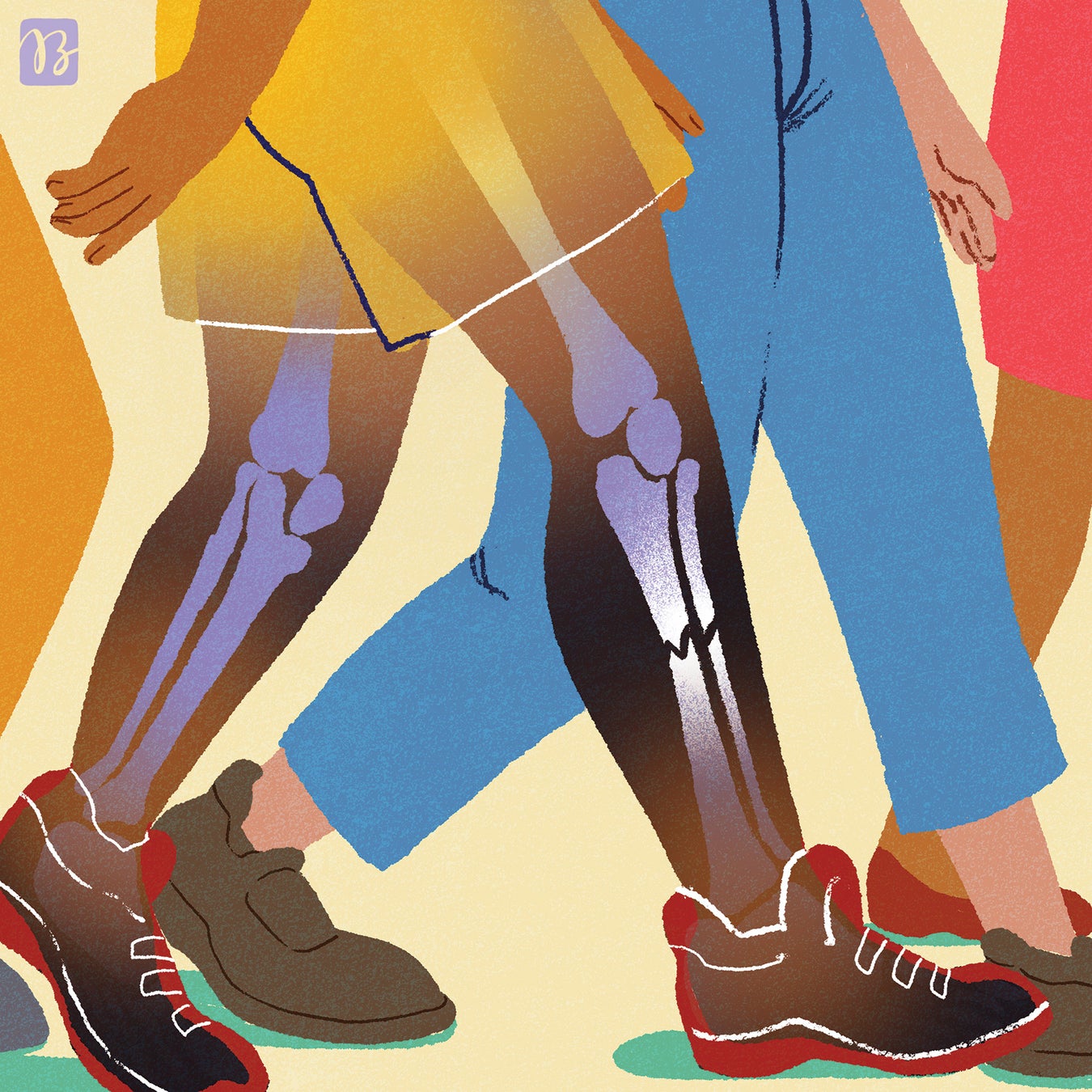 Broken Legs and Ankles Heal Better If You Walk on Them within Weeks ...