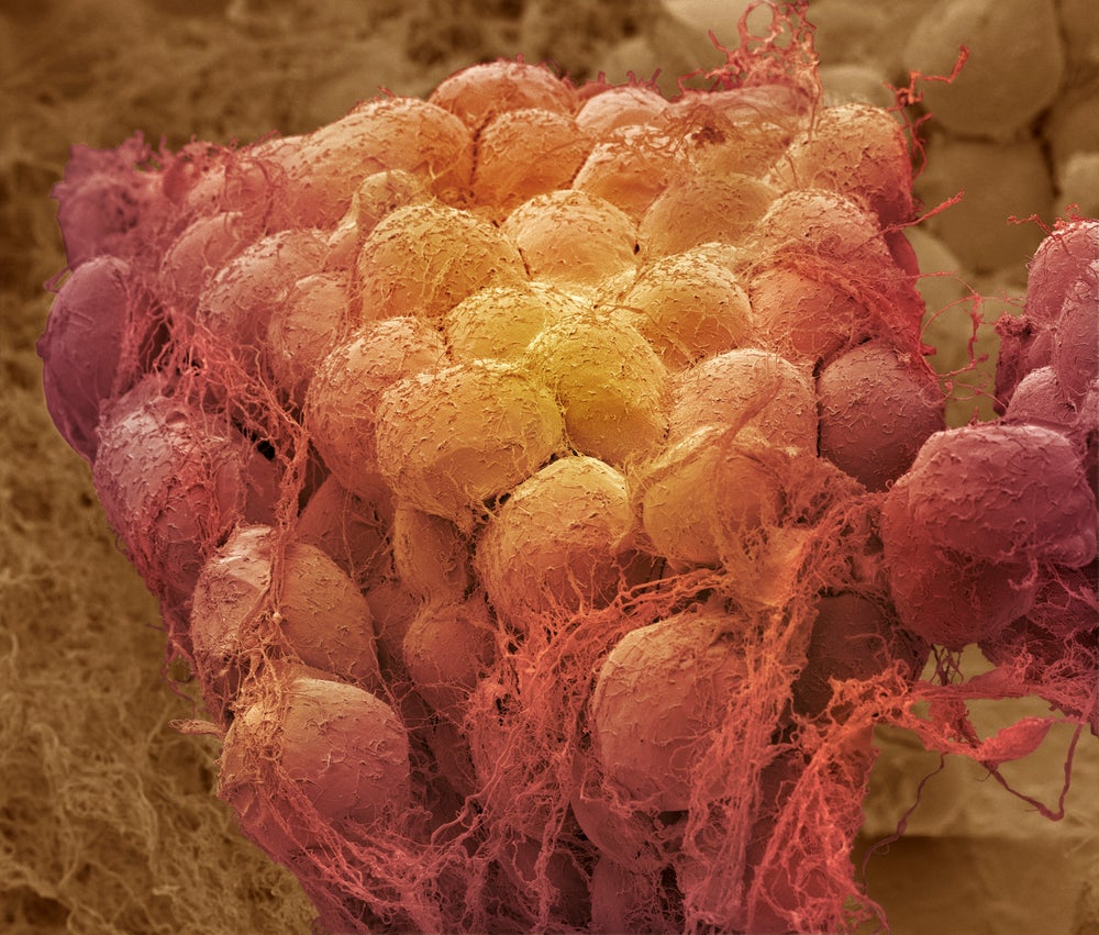 Cells in the body remember obesity. Here’s what that means for weight ...