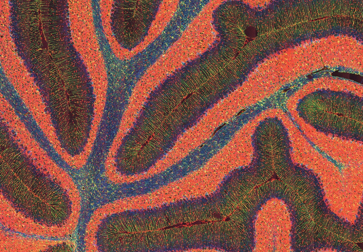 Why These Millennia-Old Brains Are So Well Preserved | Scientific American