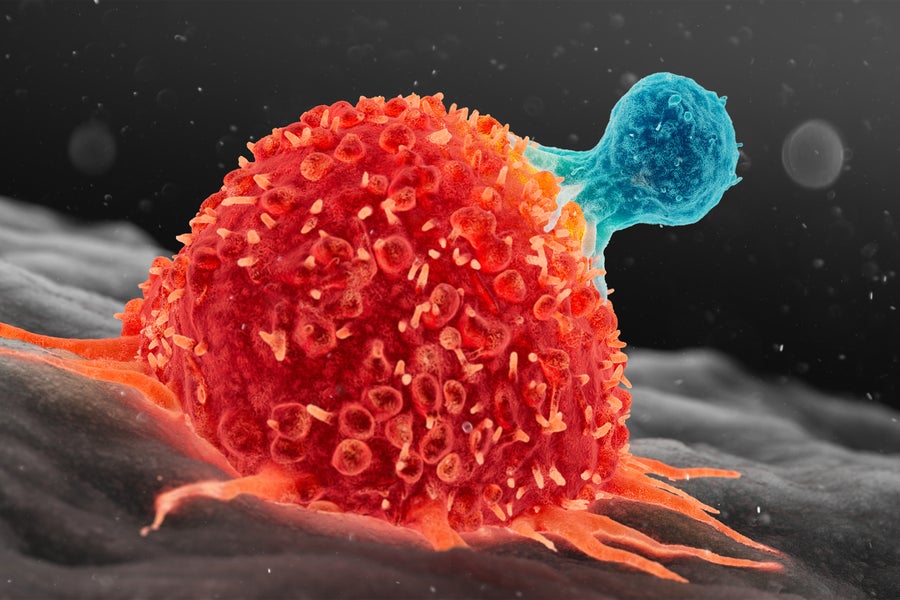 Scientists Found a Way to Supercharge Cancer-Fighting Cells ...