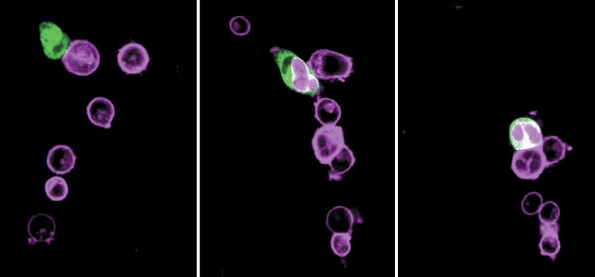 Cannibal Cells Inspire Cancer Treatment Improvement | Scientific American