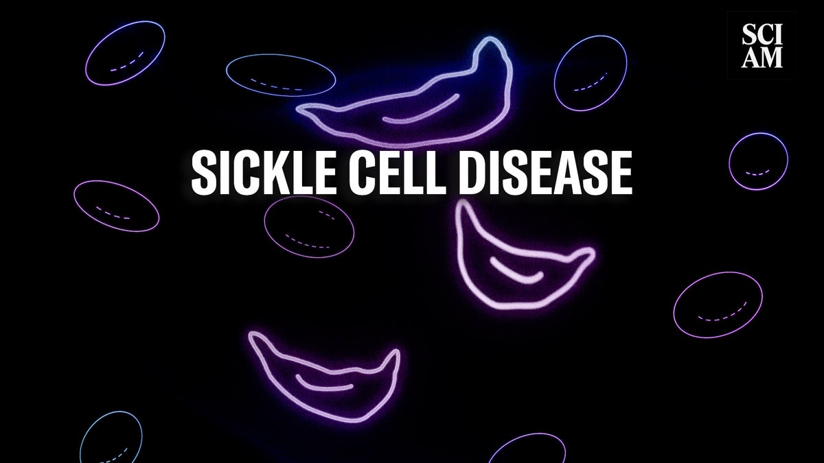 What Is Sickle Cell Disease? | Scientific American