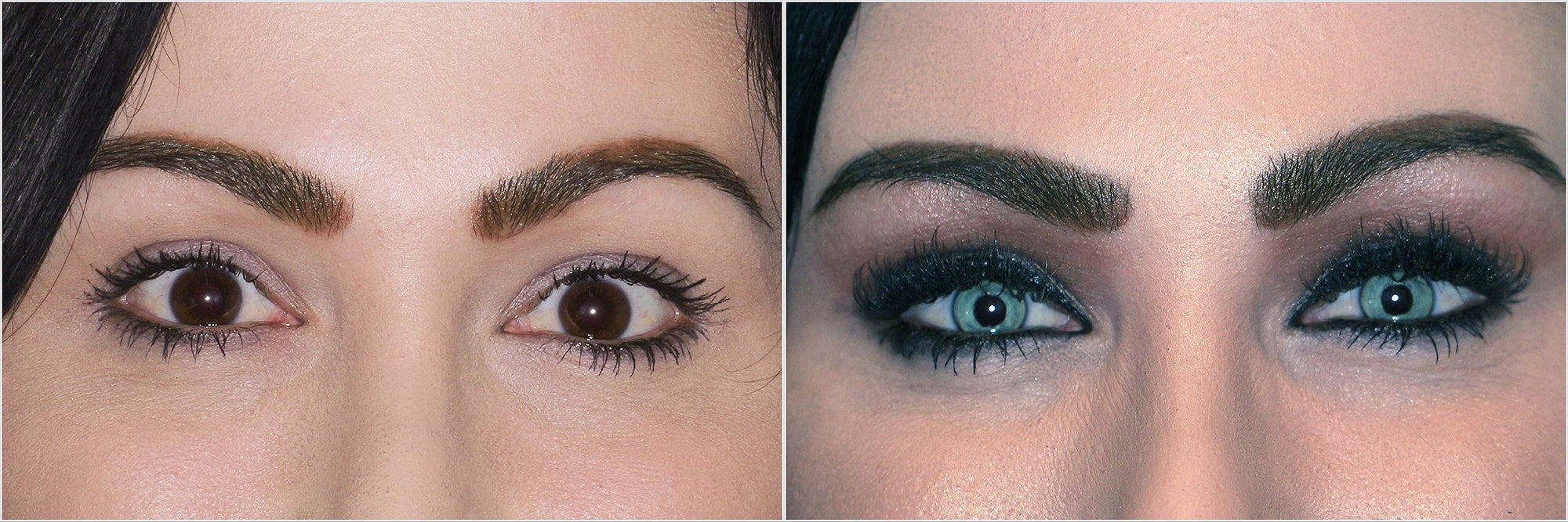 Surgeons Can Permanently Change Eye Color with Experimental ...