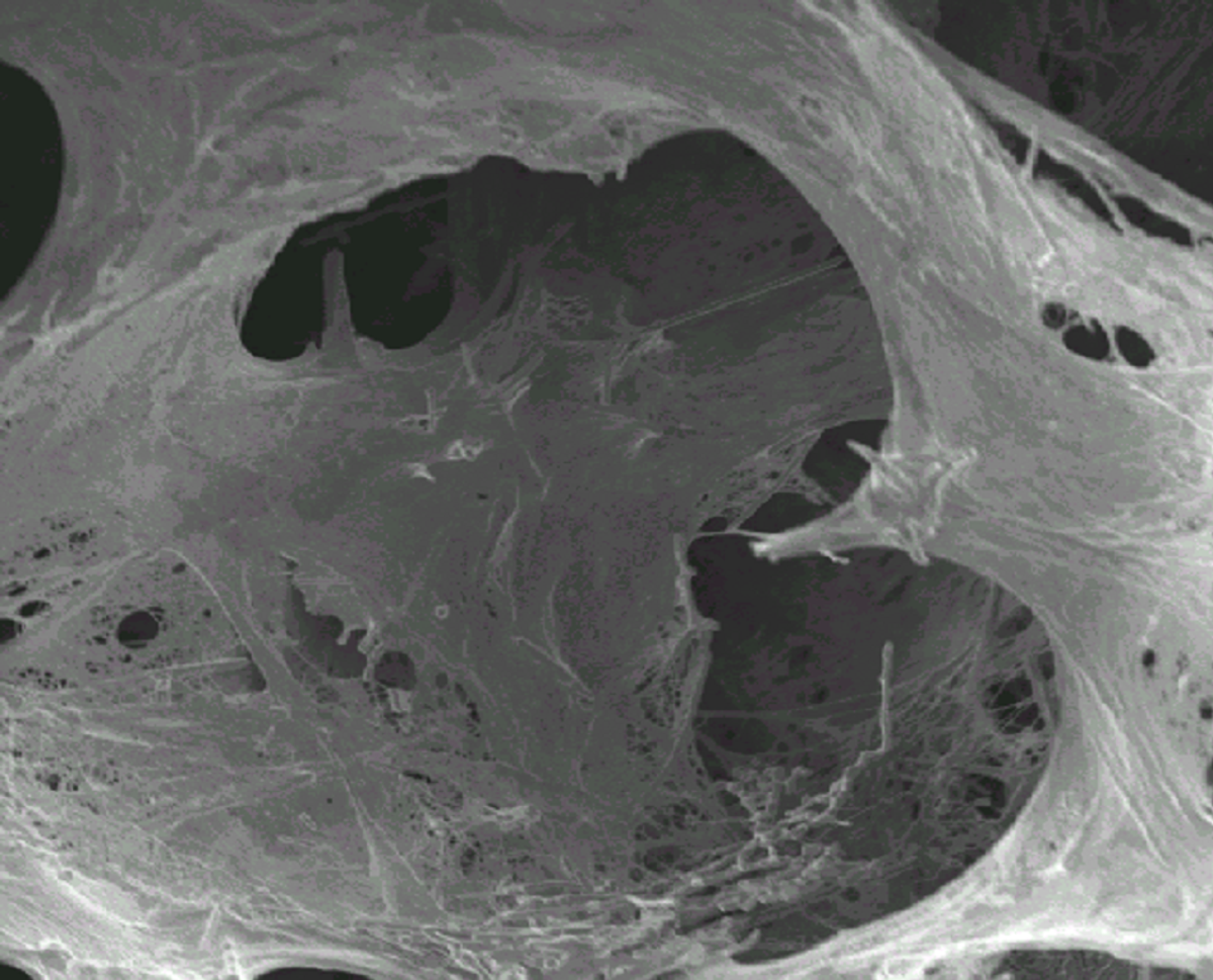 Aging More Healthily With Innovative Ceramic Materials | Scientific ...