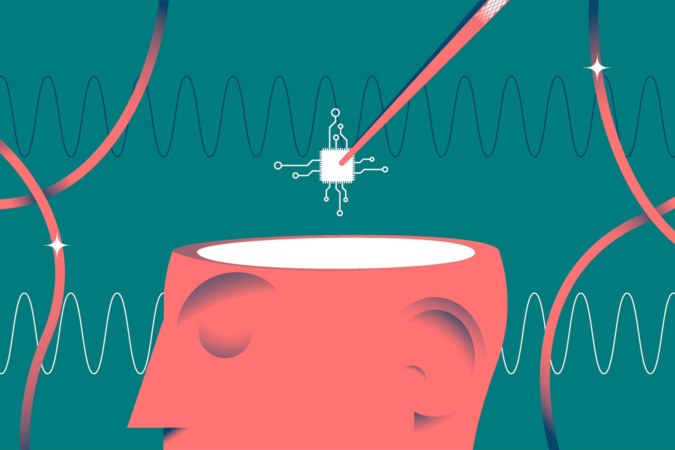 Neuralink’s First User Describes Life with Elon Musk’s Brain Chip ...