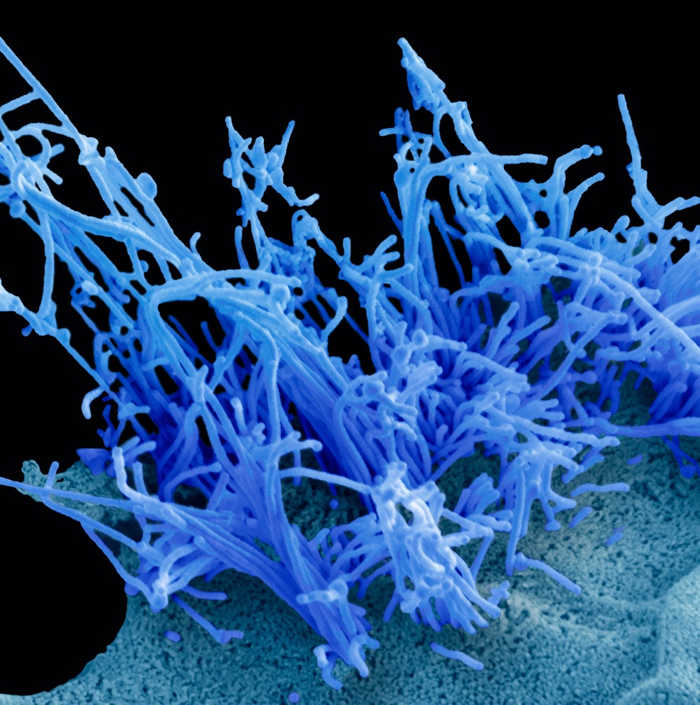 Bird Flu Virus Is One Mutation Away from Adapting to Human Cells ...