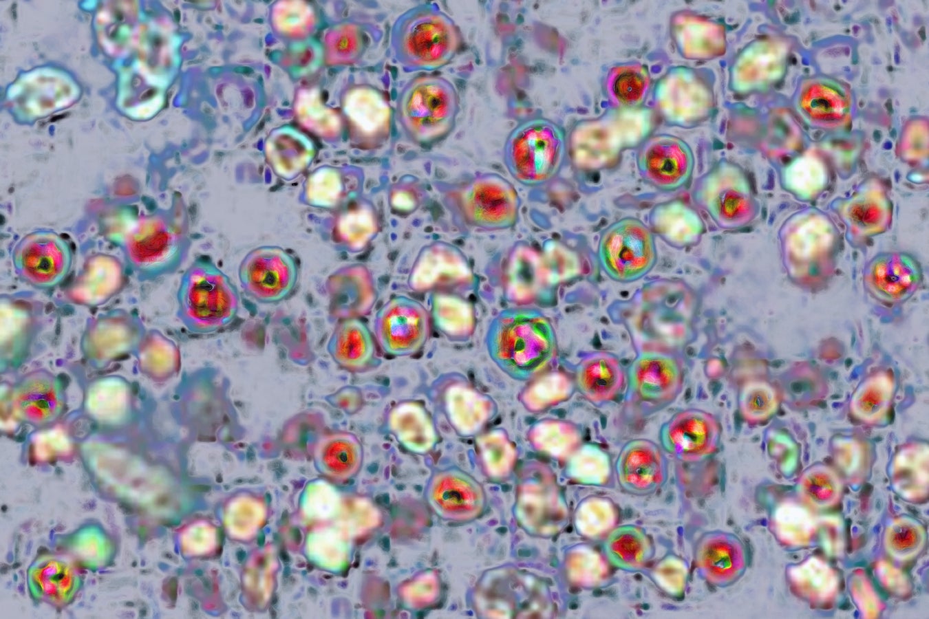 How to Check If You Have Immunity to Measles or Need Another Dose ...