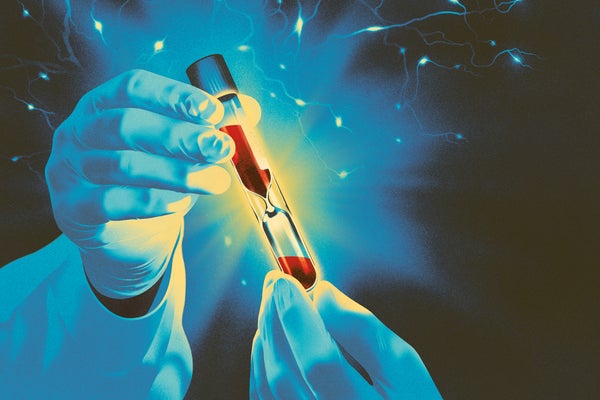 Blood Tests for Alzheimer’s Could Become Routine | Scientific American