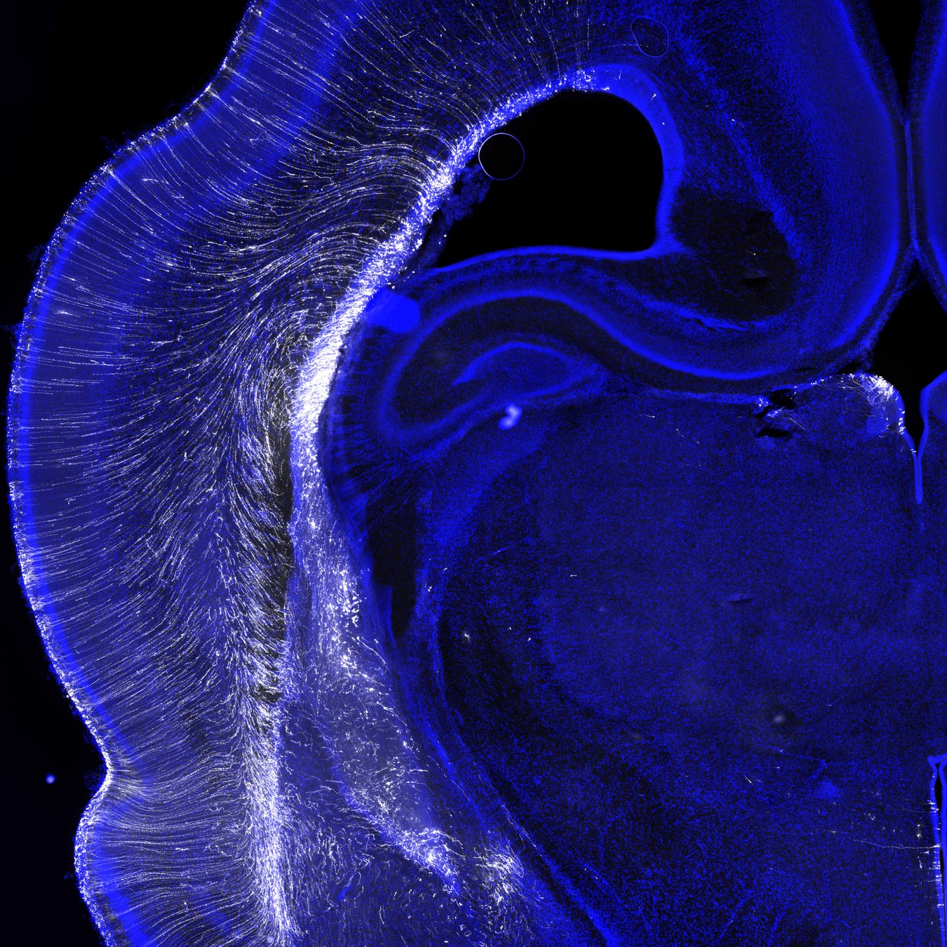 Revealing the Genes that Shape the Human Brain | Scientific American