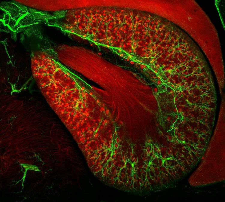 See the First Complete Map of a Mammal’s Peripheral Nervous System in ...