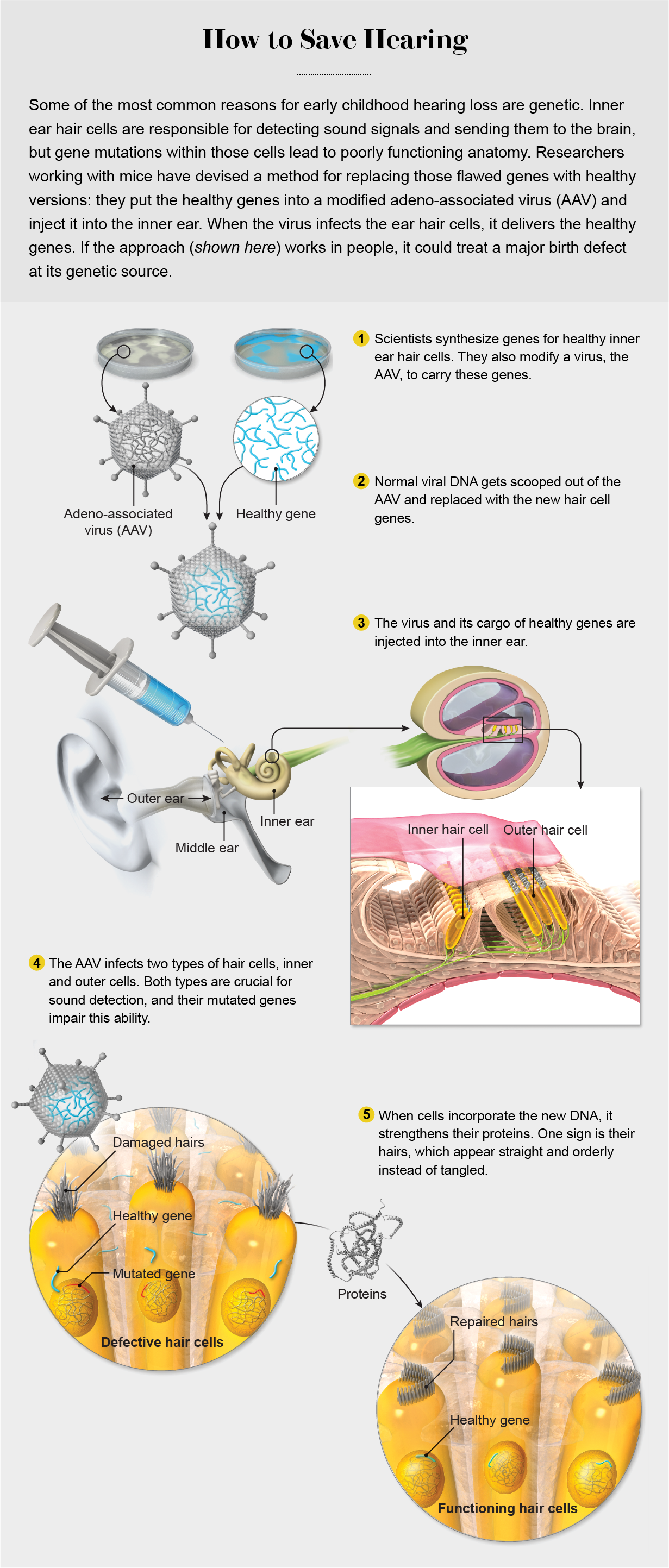 Gene Therapy Tackles a Common Birth Defect: Deafness | Scientific American