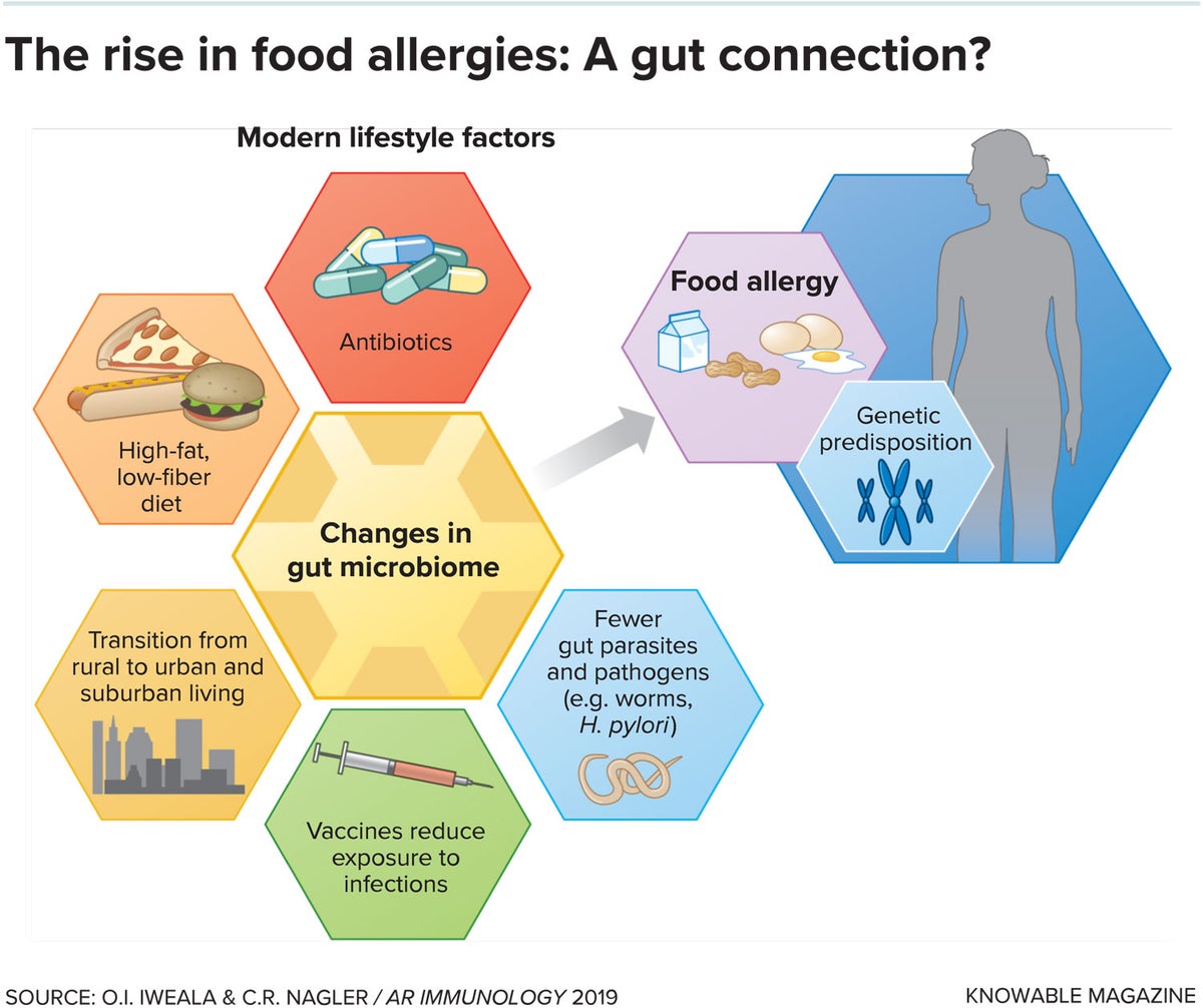 Gut Microbes May Be Key to Solving Food Allergies | Scientific American