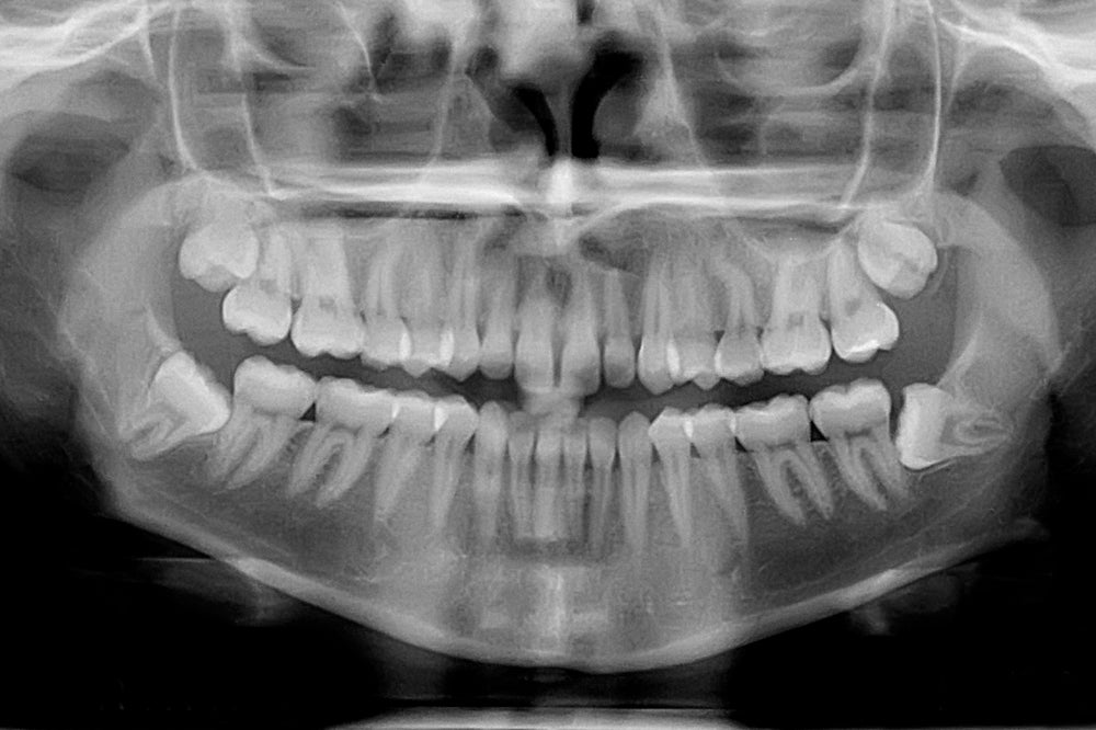 Why We Have So Many Problems with Our Teeth | Scientific American