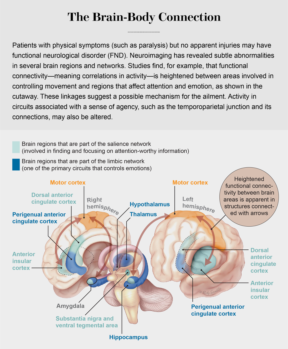 Decoding a Disorder at the Interface of Mind and Brain | Scientific ...