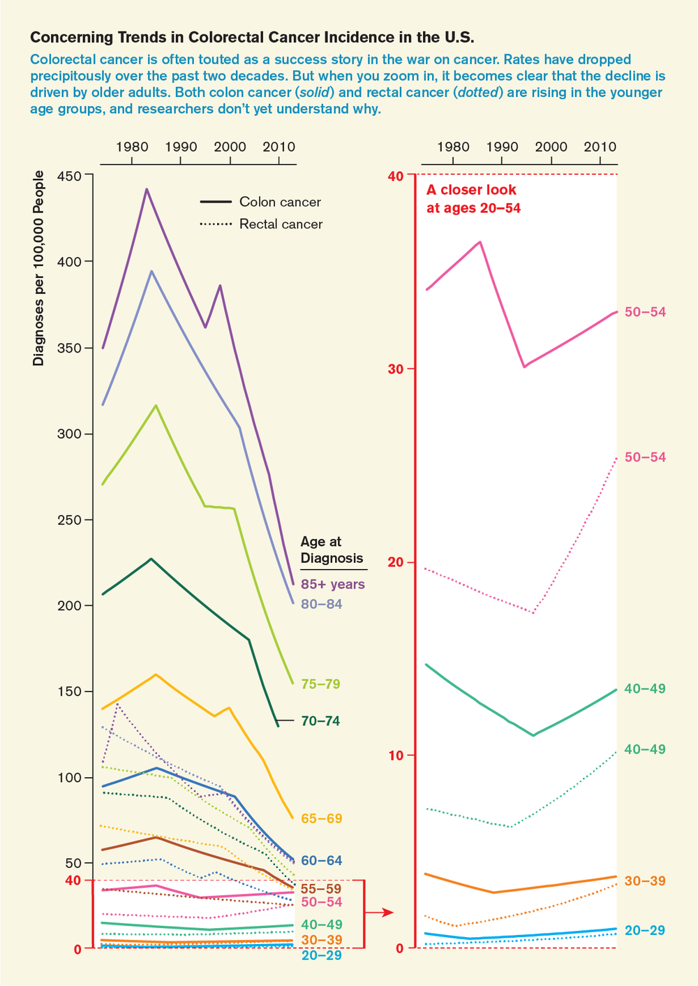 The Colon Cancer Conundrum | Scientific American