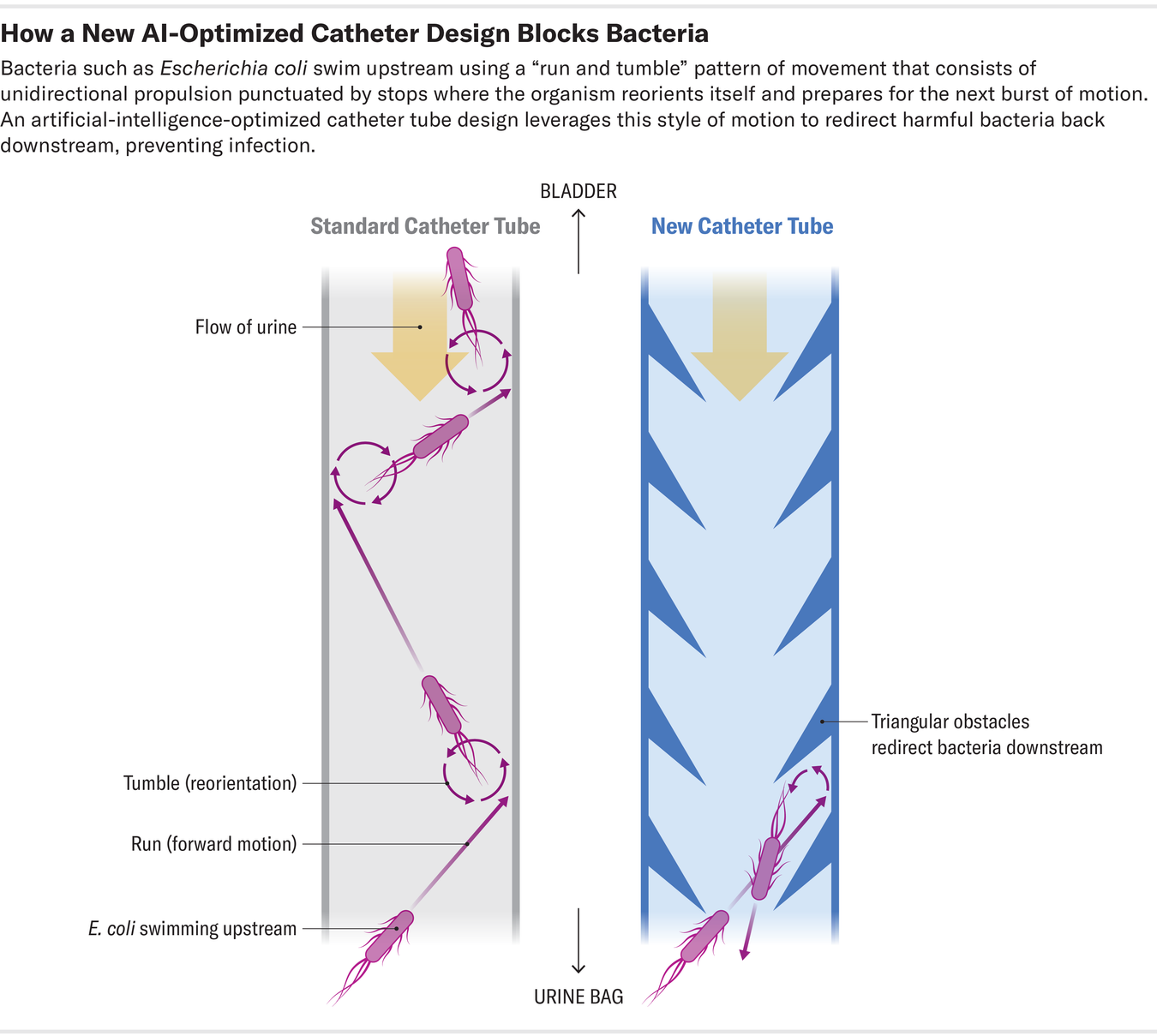AI-Optimized Catheter Design Could Prevent Urinary Tract Infections ...