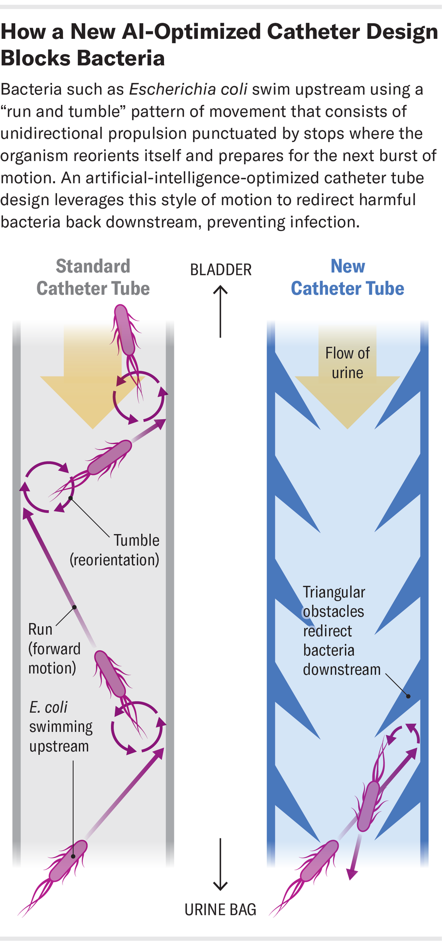 AI-Optimized Catheter Design Could Prevent Urinary Tract Infections ...