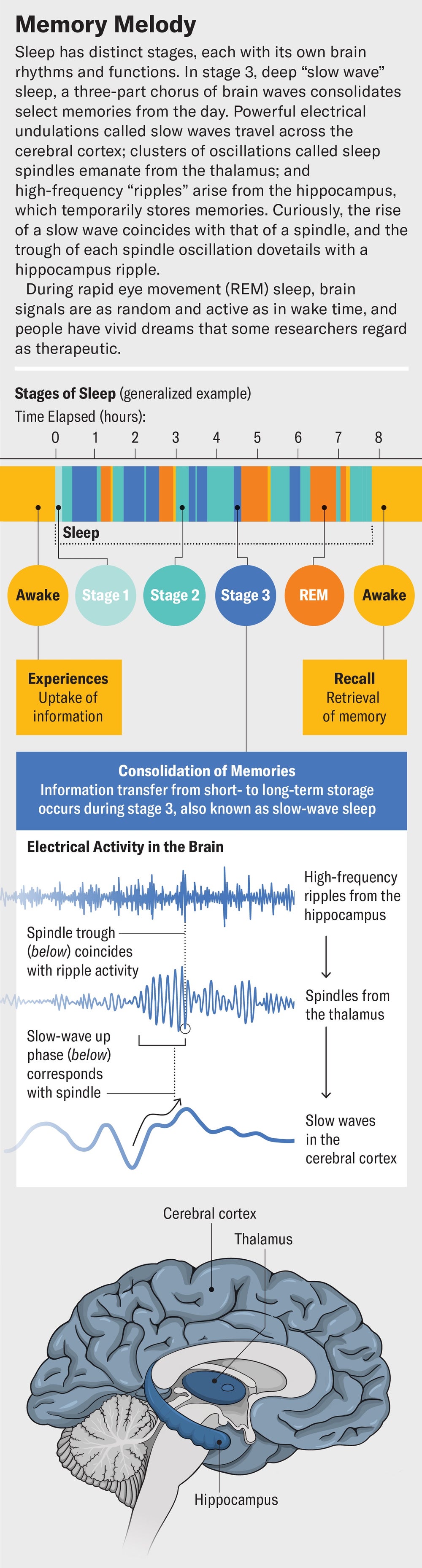 Stimulating the Sleeping Brain Could Help Heal Memory Loss or Mental ...