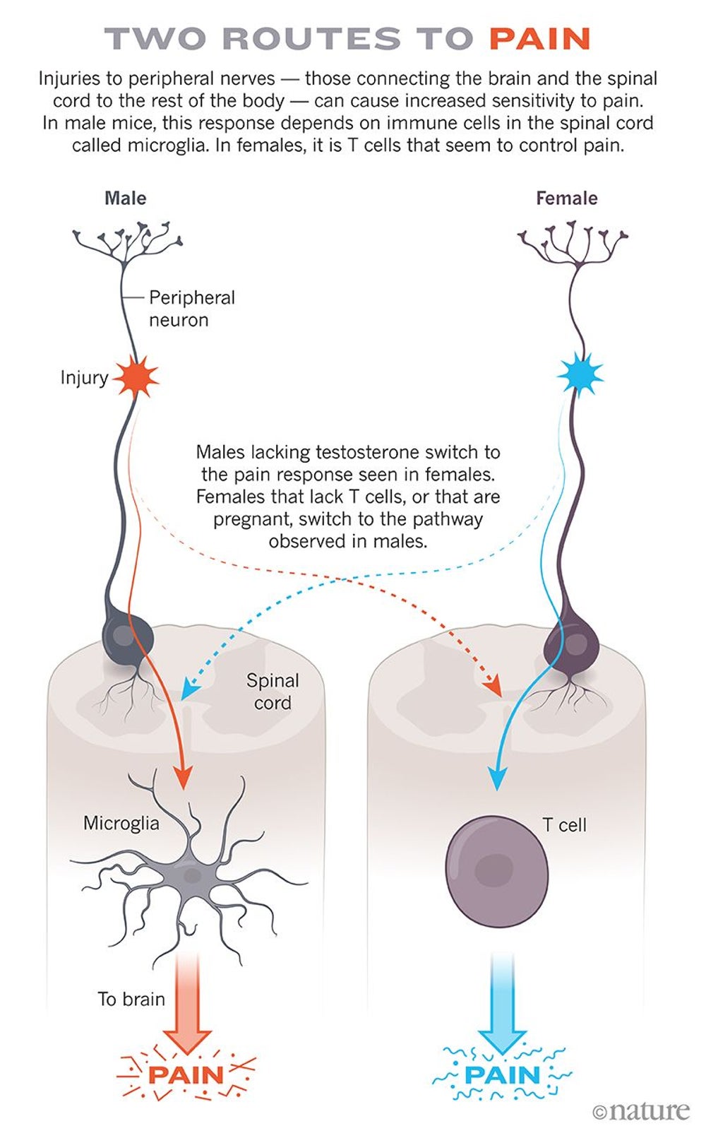 The Pain Gap | Scientific American