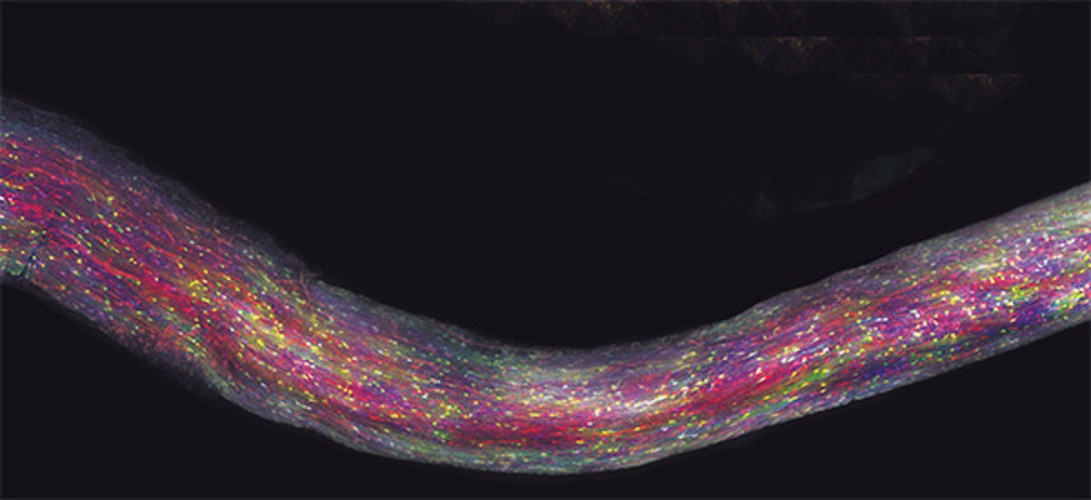 The Brainbow Connection: Viewing Nerve Cells in Living Color ...