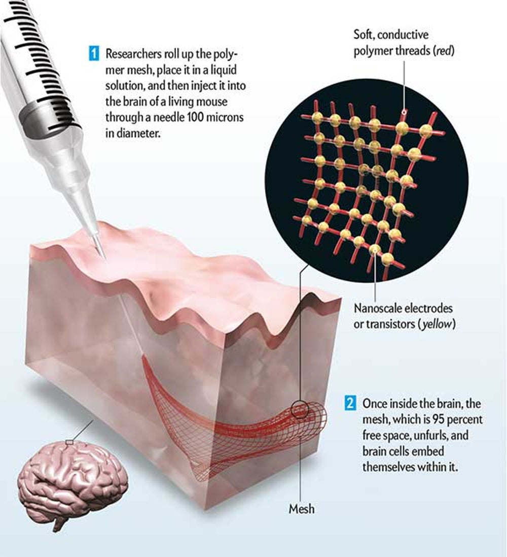 Injectable Probes Could Transform Brain Monitoring | Scientific American