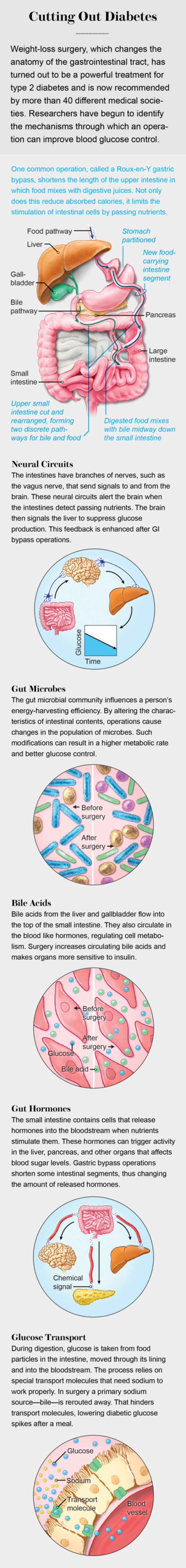 Why the Most Powerful Treatment for Diabetes Turns Out to Be Surgery ...