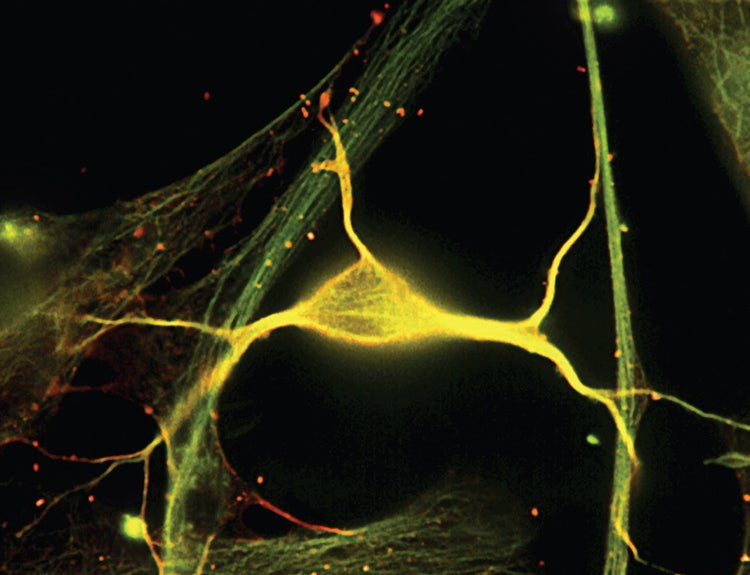 Brain Cells Communicate with Mechanical Pulses, Not Electric Signals ...