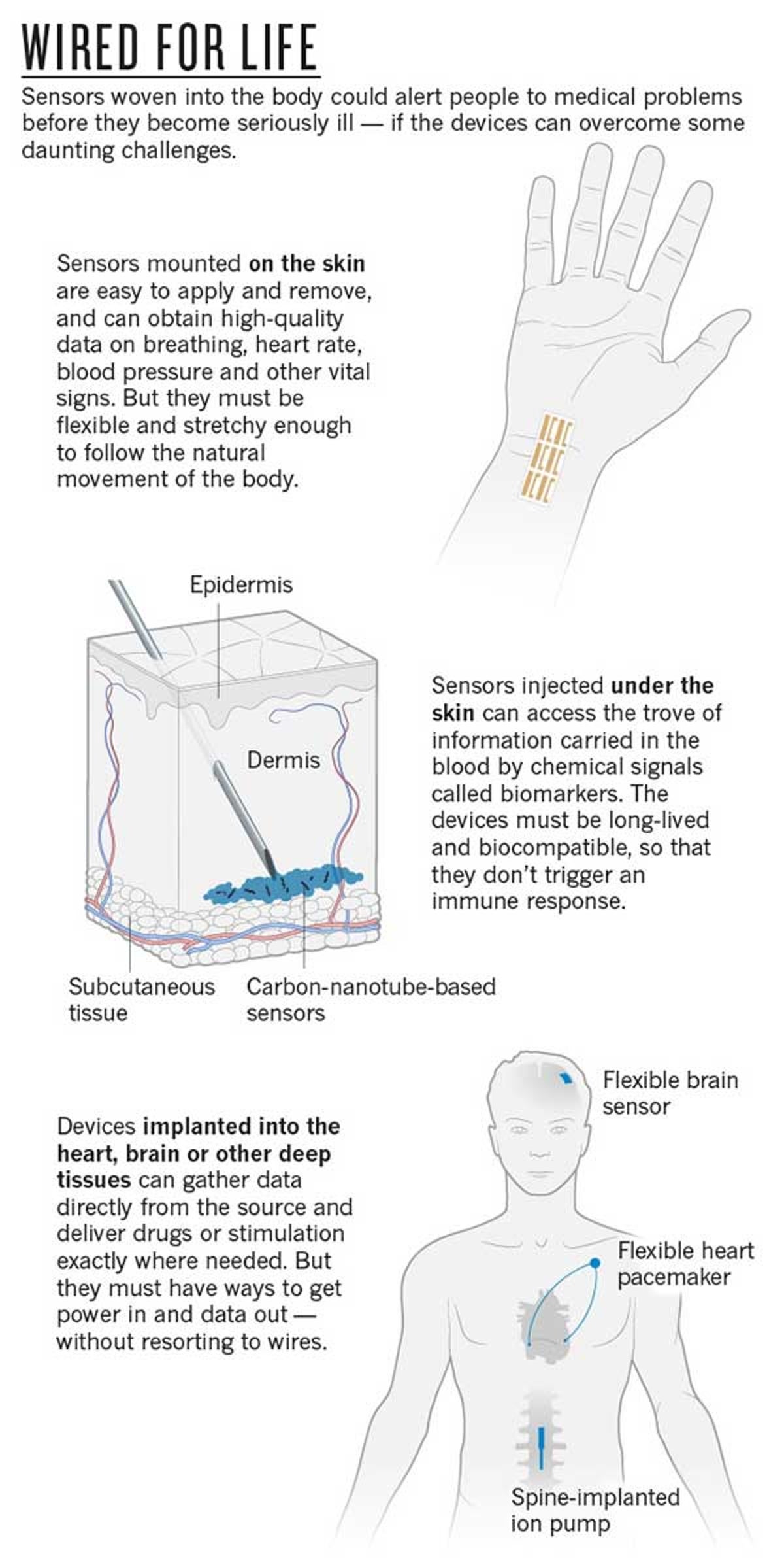 The Inside Story on Wearable Electronics | Scientific American