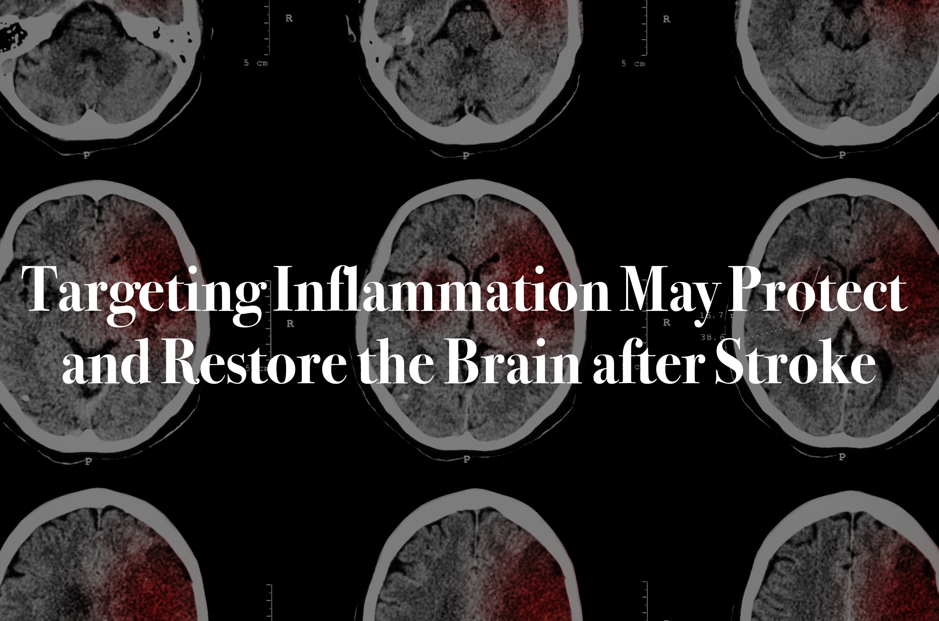 A Revolution in Fighting Clots | Scientific American