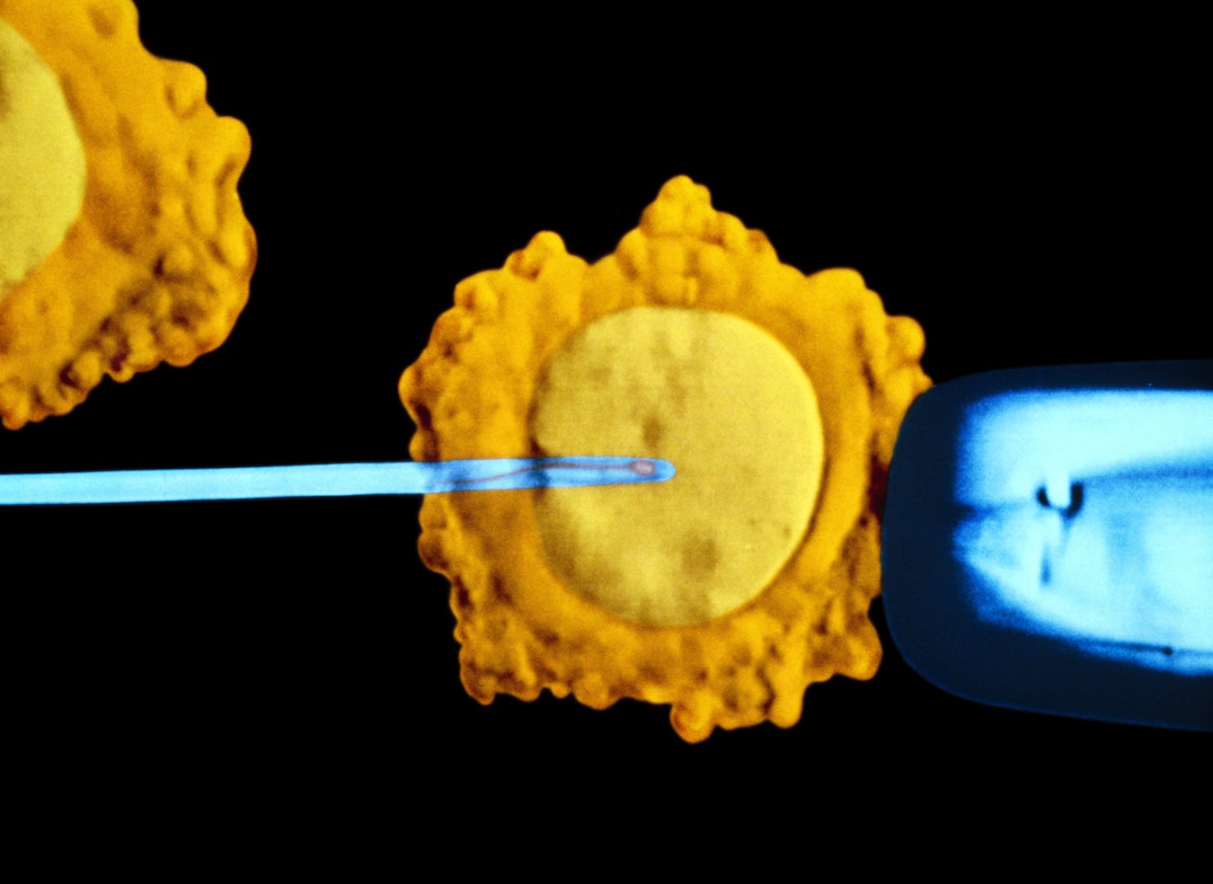 An IVF Embryo Test Aims to Prevent Miscarriages: Is It Worth It ...