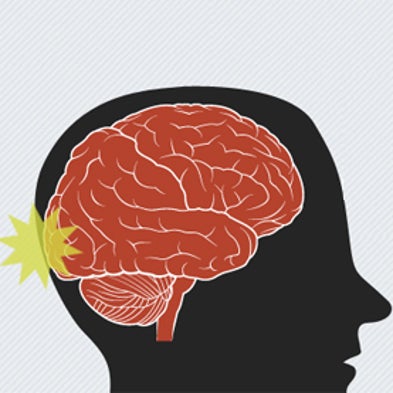 Inside Story: What Happens When Brain Hits Skull - Scientific American