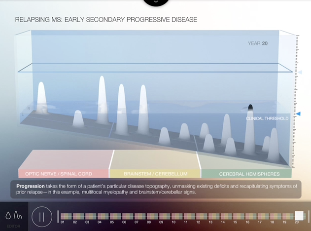Think of Multiple Sclerosis as a Leaking Swimming Pool [Video ...