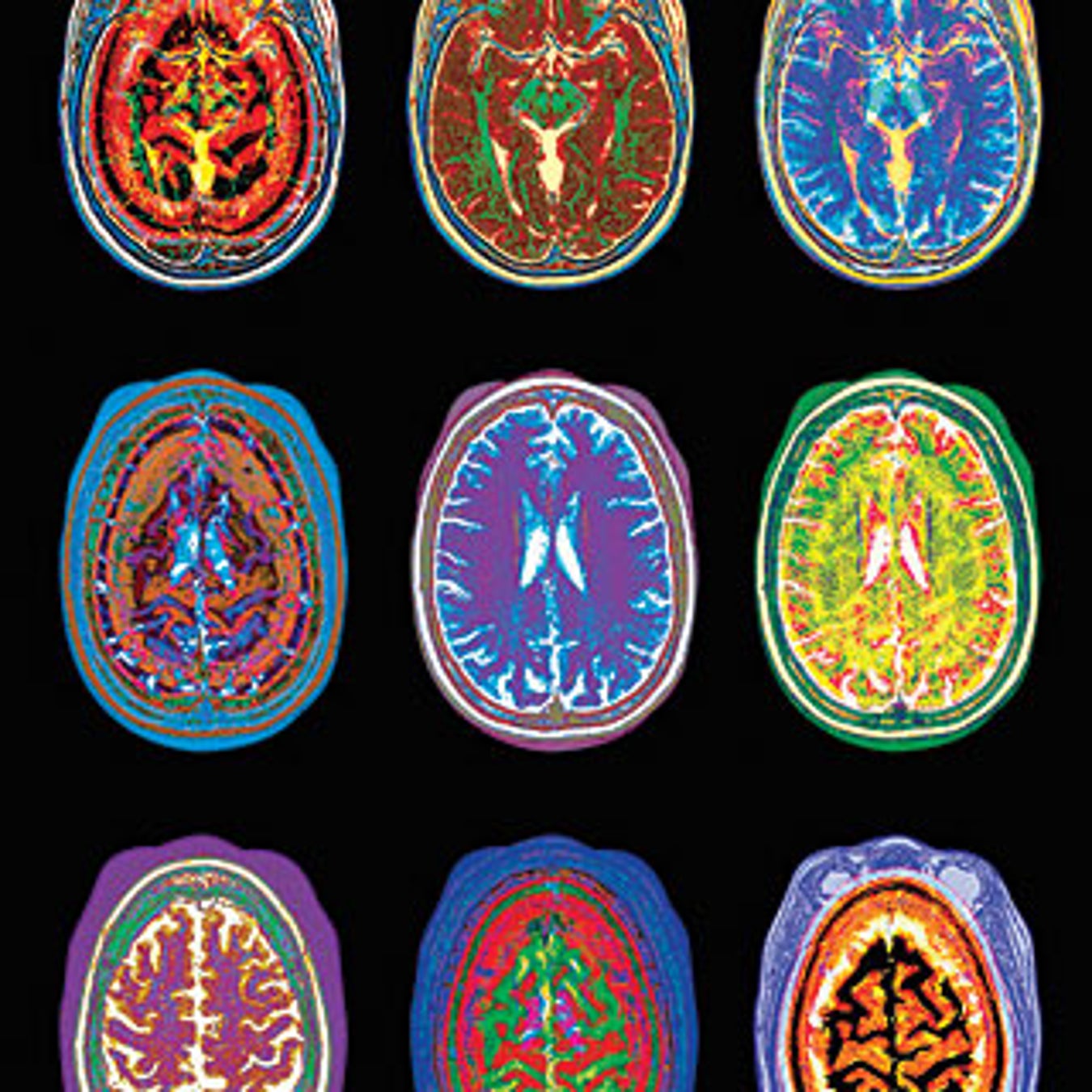 Five Ways Brain Scans Mislead Us | Scientific American
