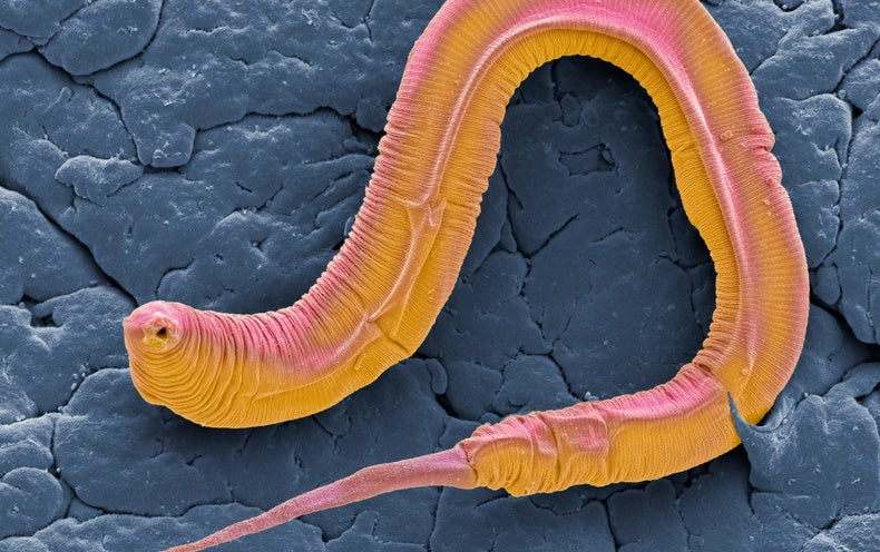 Worm Wiring Diagram May Help Us Understand Our Own Nervous System ...