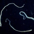 Brain-Invading Tapeworm That Eluded Doctors Spotted by New DNA Test ...