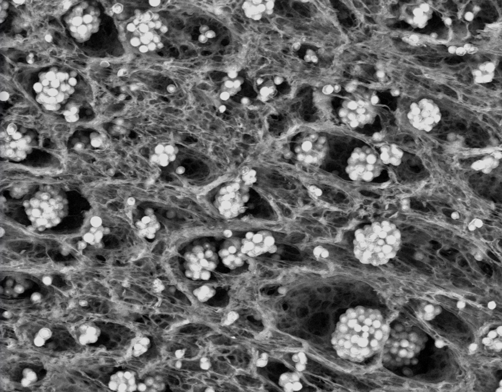 To Clean Drinking Water, Just Add Microbes | Scientific American