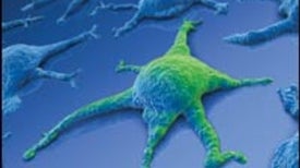 What's New in Cancer Research? - Scientific American