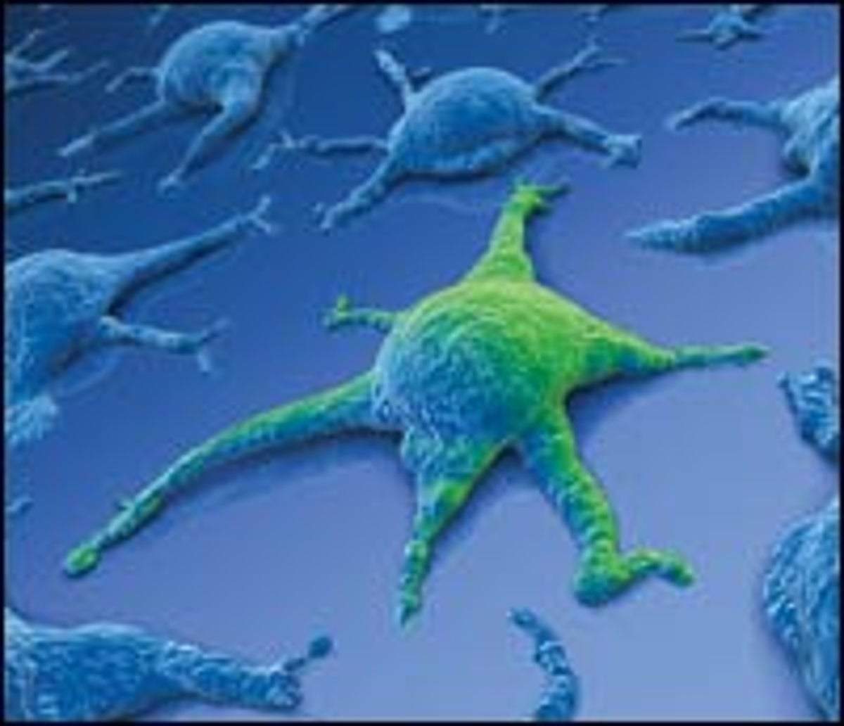 Stem Cells: The Real Culprits in Cancer? | Scientific American