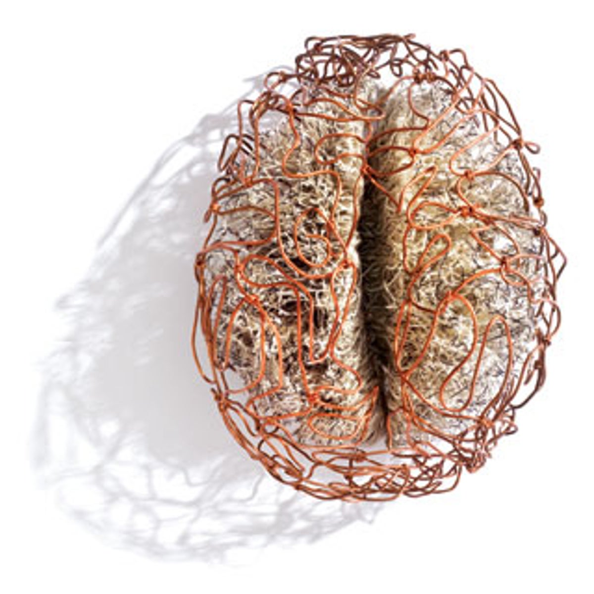 White Matter Matters | Scientific American