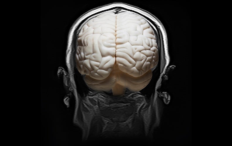 Post-Truth: The Dark Side of the Brain - Scientific American