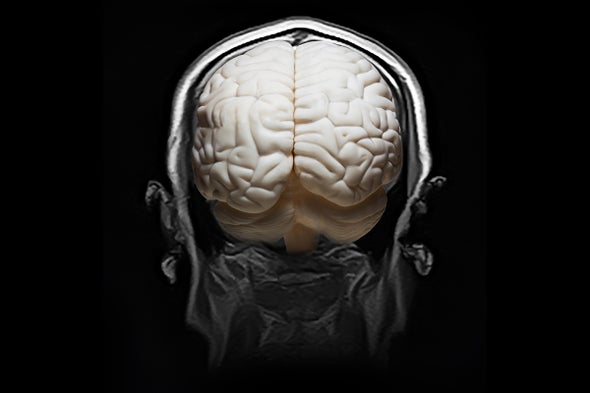 Post-Truth: The Dark Side of the Brain - Scientific American