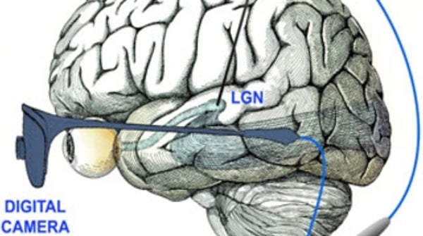 Scientists Set Sights on an Implantable Prosthetic for the Blind ...