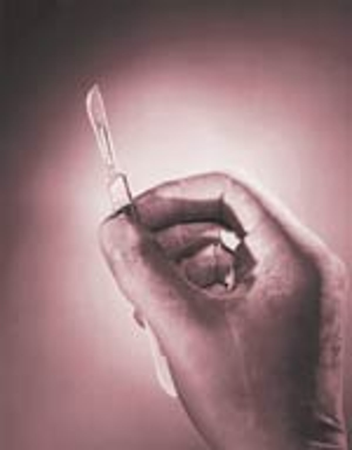 A Real Pain | Scientific American