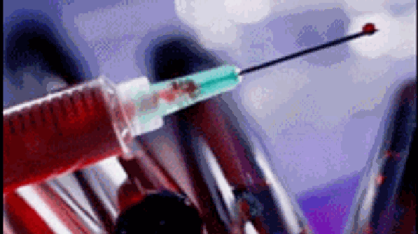 Blood Test Could Help Doctors Catch Ovarian Cancer Early - Scientific ...