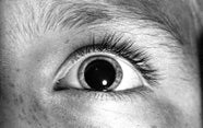 Eye Opener Why Do Pupils Dilate In Response To Emotional States 