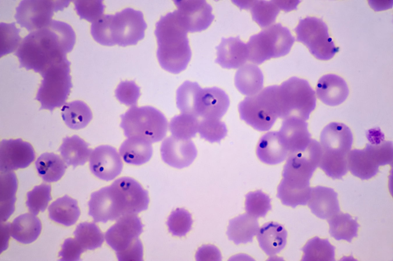 Genetic Diversity of Malaria in a Single Mosquito Bite May Be Huge ...